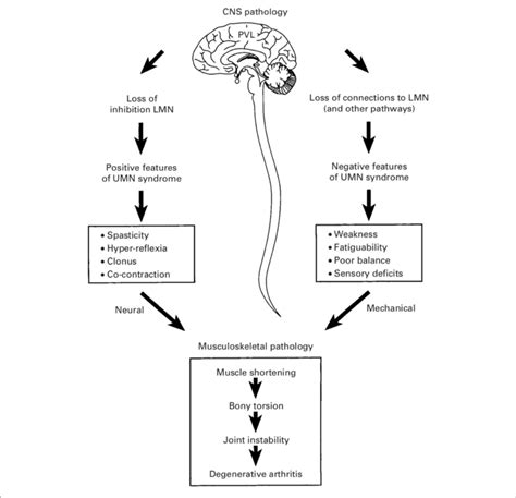 Upper Motor Neuron Disease Definition Infoupdate Org