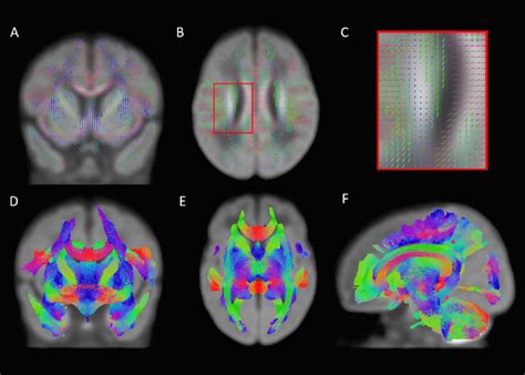 single tissue constrained spherical deconvolution csd fixel template download scientific