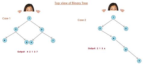 print nodes in top view of binary tree javabypatel data structures and algorithms interview