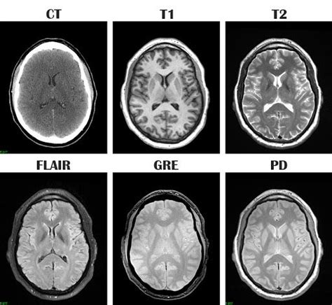 Pin Oleh Jenny Duscio Di Upgrading To Mri Di Radiologi