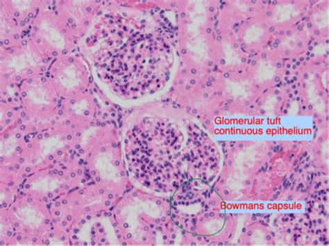 Glomerular Disease Flashcards Quizlet