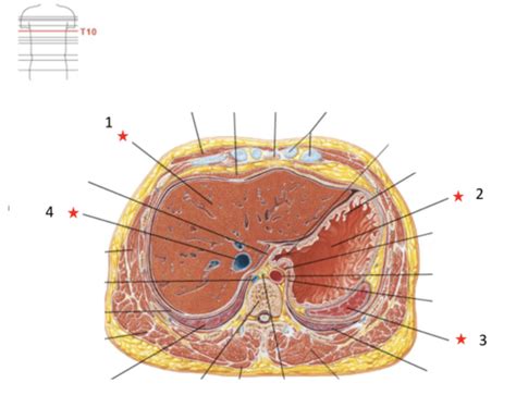 Cross Sectional Anatomy And L1 Pics Flashcards Quizlet