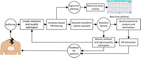 the flowchart of ecg signal processing pipeline implemented on smart download scientific
