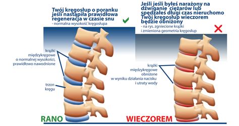 JAKI JEST NAJLEPSZY MATERAC NA BÓL KRĘGOSŁUPA LĘDŹWIOWEGO JAK POZBYĆ