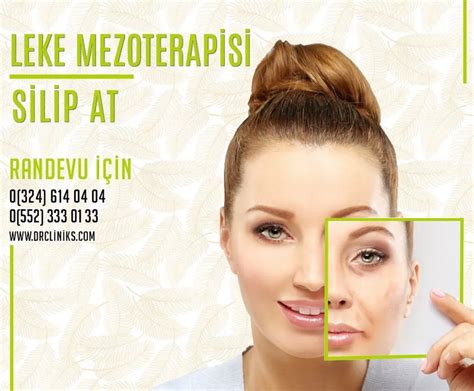 Leke Mezoterapisi Nedir Dr Cliniks Sağlık Güzellik Bakım