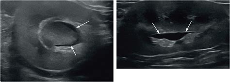Feline Abdominal Ultrasonography Whats Normal Whats Abnormal Renal