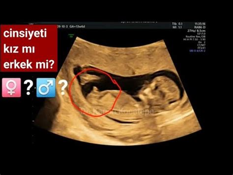 13 hafta 6 günlük 3 aylık bebek cinsiyeti ultrasonda belli olur mu
