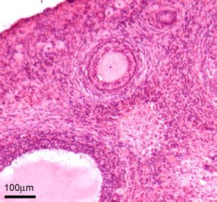 In The Mature Or Graafian Follicle Of The Ovary Telegraph
