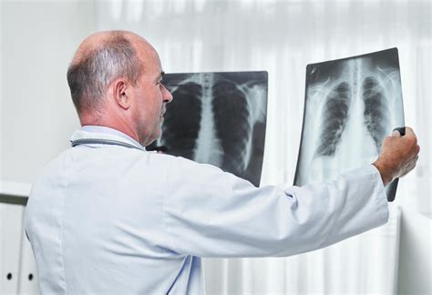 Lo que debes saber sobre los Rayos X Resobert Medicina Radiología
