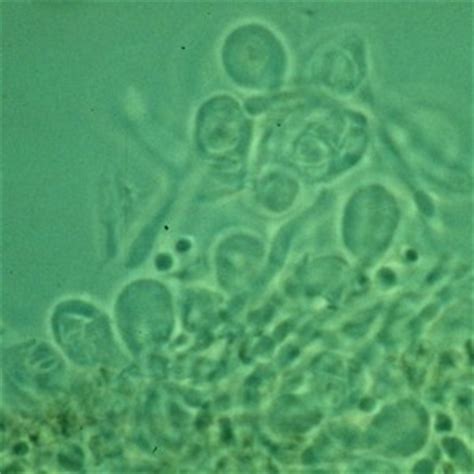 Hemiascomycetes