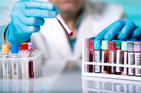 Prueban un nuevo análisis de sangre que detecta 20 tipos de cáncer con