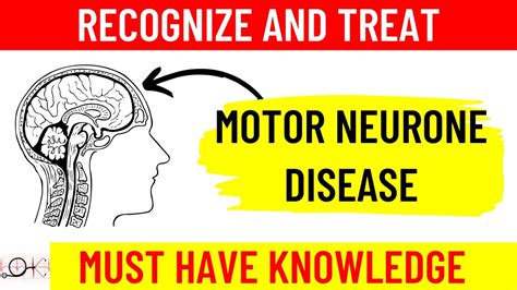 What Is Motor Neuron Disease MND All You Need To Know Causes
