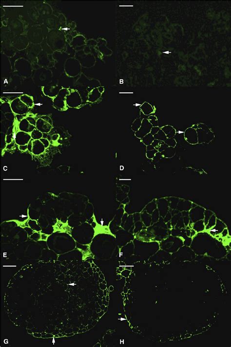 Immunofl Uorescence Localization Of JIM11 And JIM20 Epitopes During