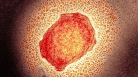 Maymun Çiçeği Virüsü Nasıl Bulaşır Yeni Belirtileri Nelerdir Op Dr