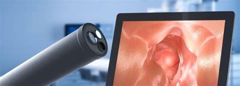 fibroscopie Clinique Méditerranéenne