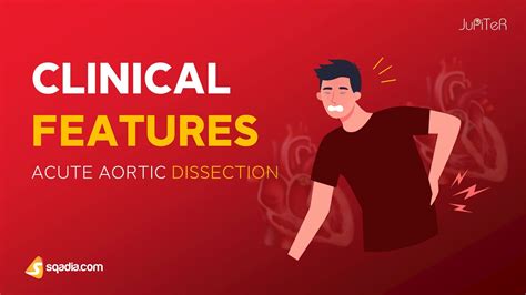 Acute Aortic Dissection Clinical Features