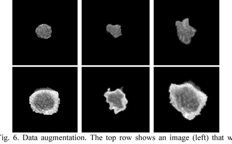 figure 1 from adaptive estimation of active contour parameters using convolutional neural