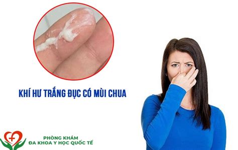 Khí hư trắng đục có mùi chua phải chăng là dấu hiệu ung thư cổ tử cung