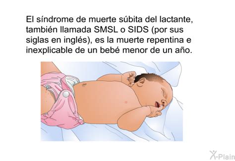 PatEdu Síndrome de muerte súbita del lactante SMSL