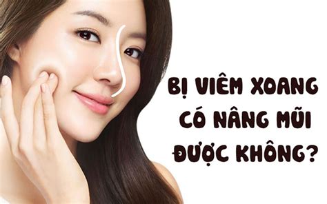 Bị viêm xoang có nâng mũi được không Trường hợp nào không được nâng mũi