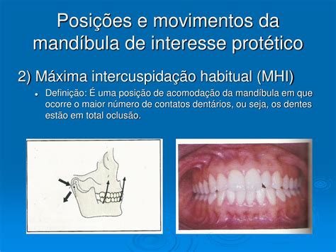 PPT Oclusão em Prótese Dentária PowerPoint Presentation free