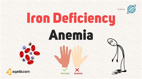 Iron Deficiency Anemia