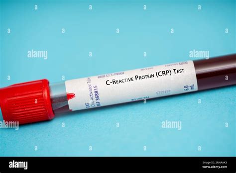 C Reactive Protein Crp Test This Test Measures The Levels Of Crp A