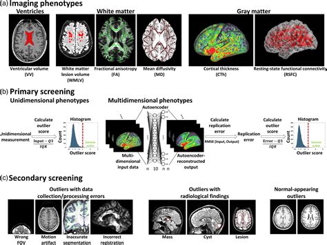 Human Brain Mapping Neuroimaging Journal Wiley Online Library