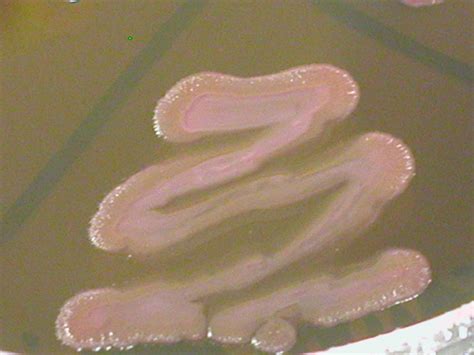 Pseudomonas Aeruginosa Emb Agar