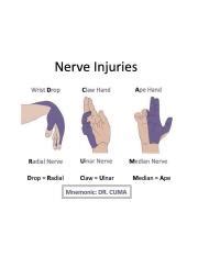 Understanding Nerve Injuries Wrist Drop Claw Hand Mnemonic Course
