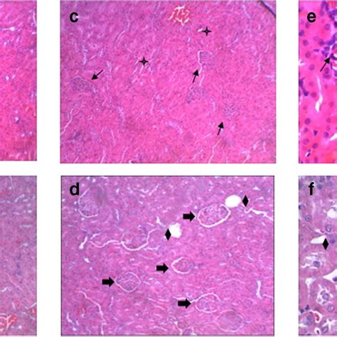 Histological Photomicrographs Using Hematoxylin And Eosin Staining Of