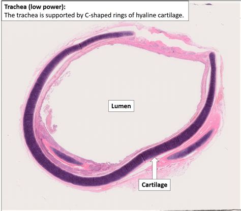 Trachea Normal Histology NUS Pathweb NUS Pathweb