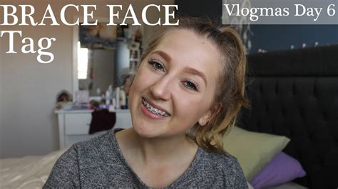 Years Of Braces The Brace Face Tag Vlogmas Day Bec S Vlogs