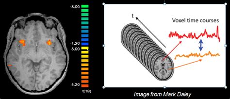 fmri crex
