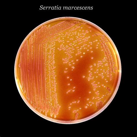 Klebsiella Entrobacter Serratia Group HowMed
