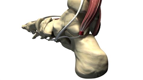 FHL Diagnostic