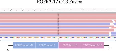 Structure Of FGFR TACC Gene Fusions Identified By Next Generation