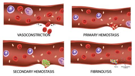 Hemostasis Physiology Stages Key Players Disorders