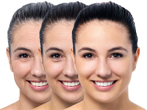 Rejuvenescimento Facial Como Deixar O Rosto Jovem Dream Plastic