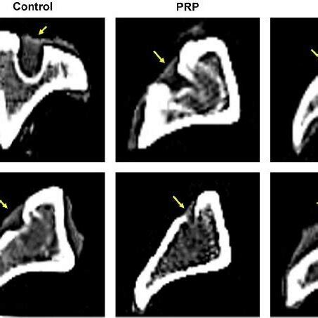 Histological Score Of The Tibial Bone Defects At 6 Weeks PO A And 12
