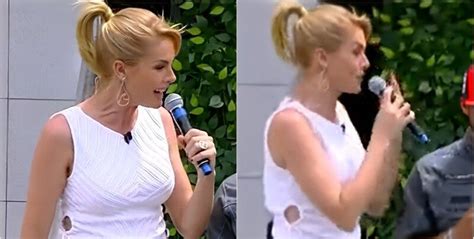 Ana Hickmann Deixa Escapar Hematoma No Bra O Ap S Caso De Agress O V Deo