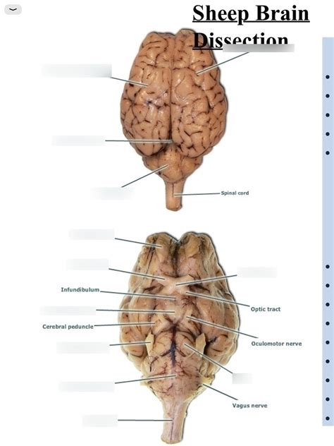 Sheep Brain Dissection Diagram Quizlet