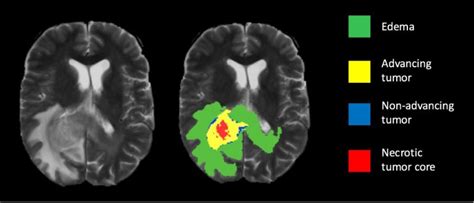 image segmentation with machine learning dataflair