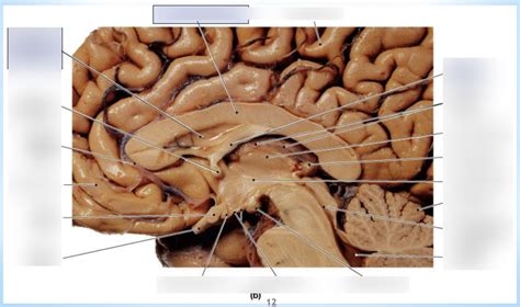 Sagittal Section Of Brain Diagram Quizlet