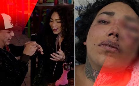 Paola Su Rez Integrante De Las Perdidas Hospitalizada Tras Agresi N