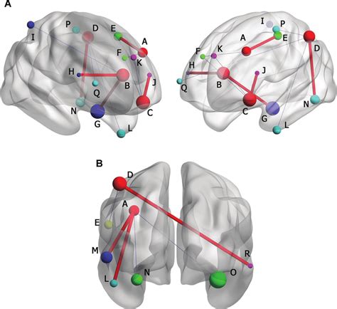 a brain functional connectivity fc of rs fmri in mdd without cm download scientific
