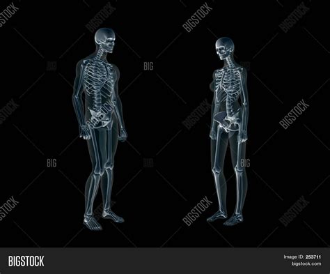 Xray X Ray Human Body Man Woman Image Photo Bigstock