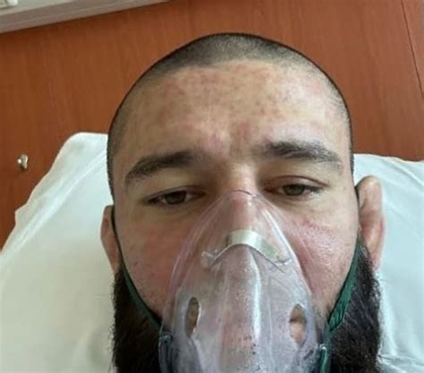 UFC Superstar Khamzat Chimaev Reveals Alarming Hospital Pictures