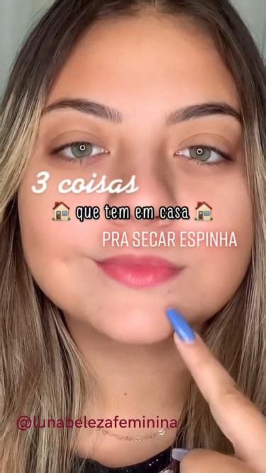 Dicas Caseiras Para Secar Espinha Como Tirar Espinhas Dicas De