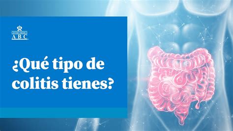 Qué tipo de colitis tienes YouTube